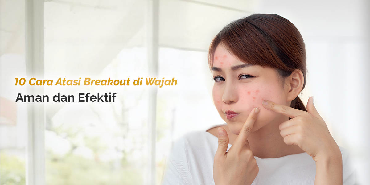 10 Cara Atasi Breakout di Wajah: Aman dan Efektif – Tull Jye